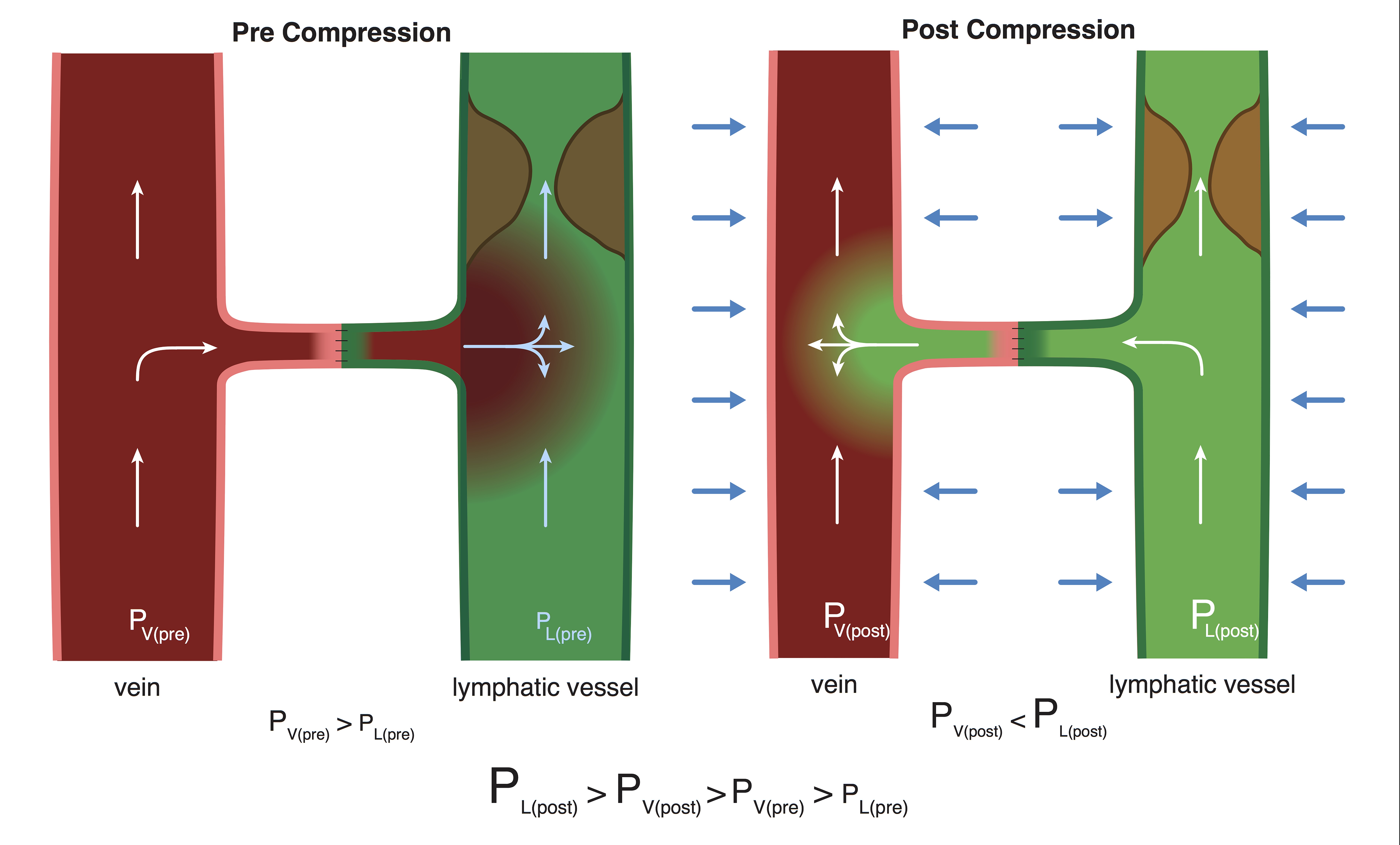 Immediate Limb Compression Following Supermicrosurgical ...