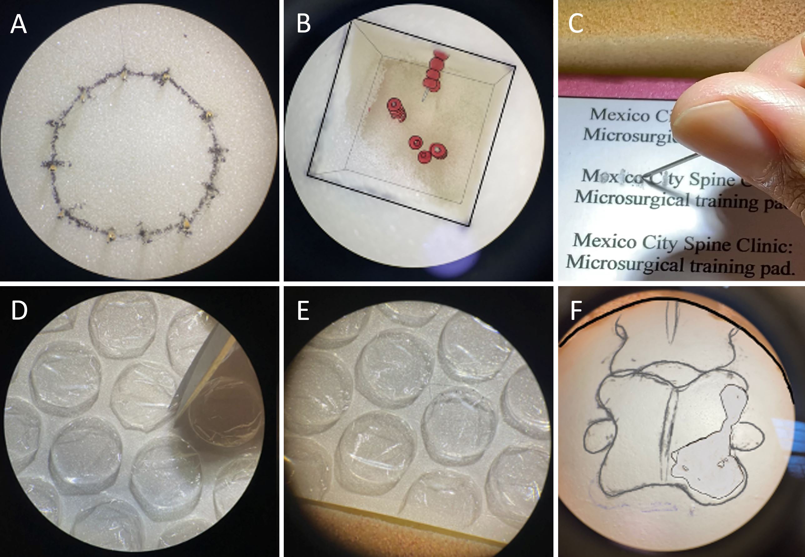 An Innovative Model for Microsurgical Training at a Spine Surgery ...